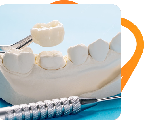 PROTETICĂ - Dr. Branza Cristian